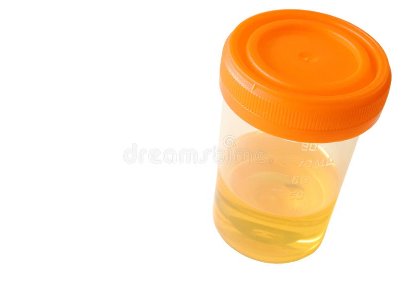 Urine sample stock photo. Image of examine, heal, glass - 496756