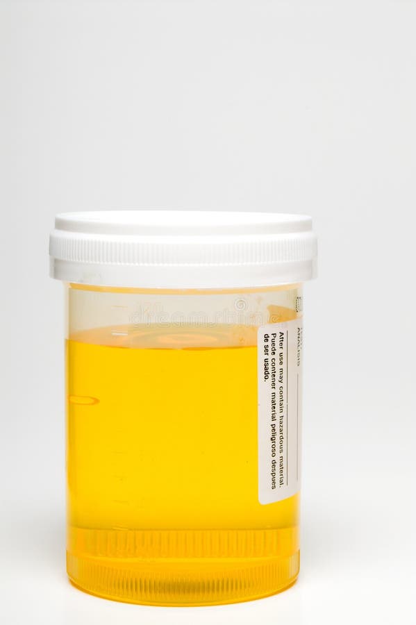 Urine Sample stock image. Image of healthy, test, healthcare - 5148015