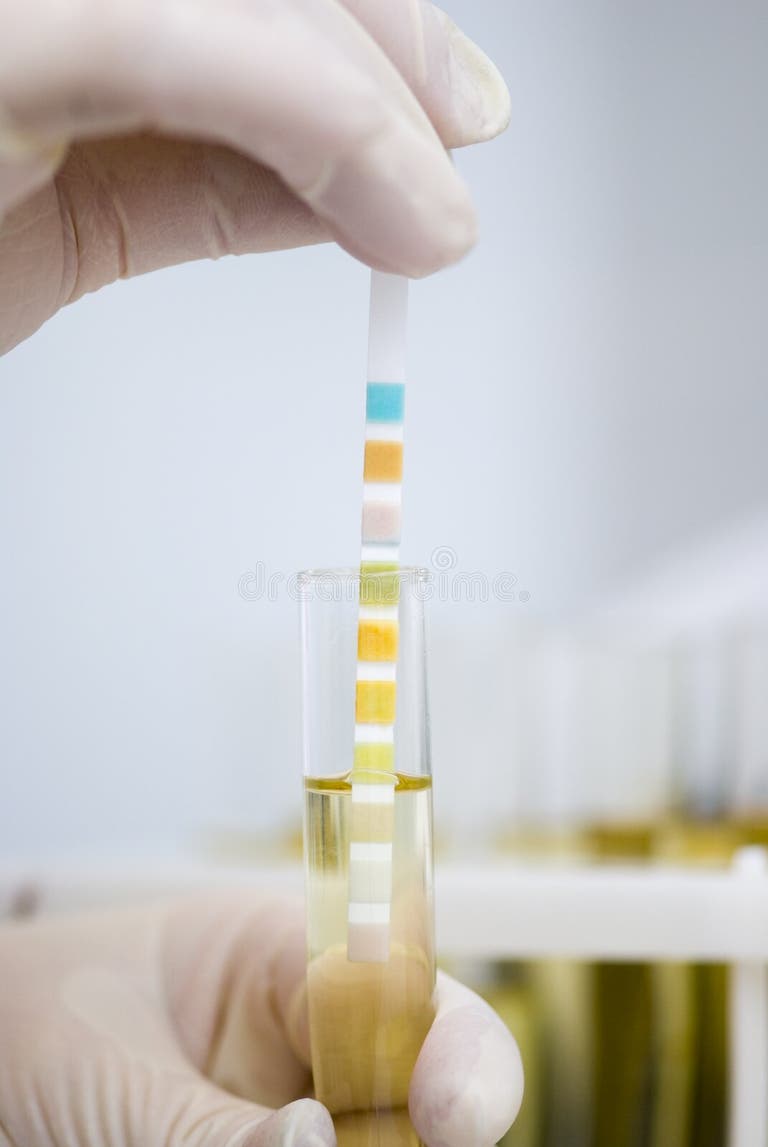 353 Urine Lytes Chart Stock Photos - Free & Royalty-Free Stock Photos ...