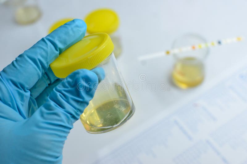 Urine Sample stock photo. Image of drug, test, urine - 21384178
