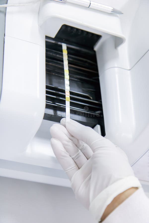 Detail Of A Urine Test Tube For Drug Detection And Doping Stock Photo ...