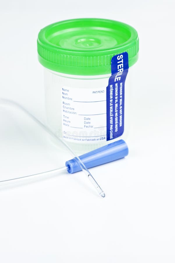 Urine Sample stock image. Image of petri, sample, science - 51810763