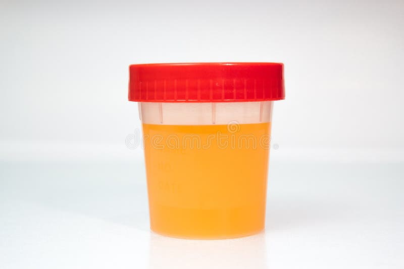 Urine Sample stock photo. Image of holder, container - 31397310