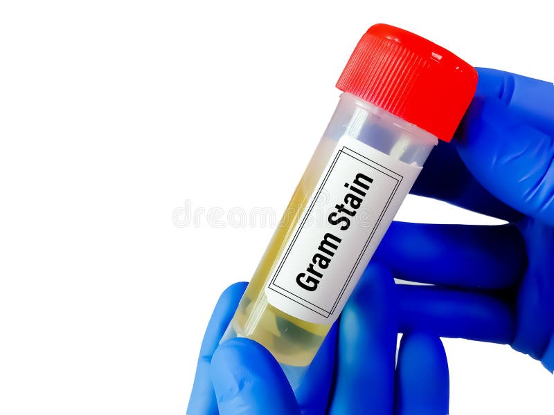 Urine Sample for Gram Stain Gram Satin Testing Stock Photo - Image of ...