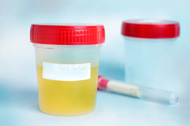 Urine Sample in Jar with Blank Label on Table, Space for Text ...