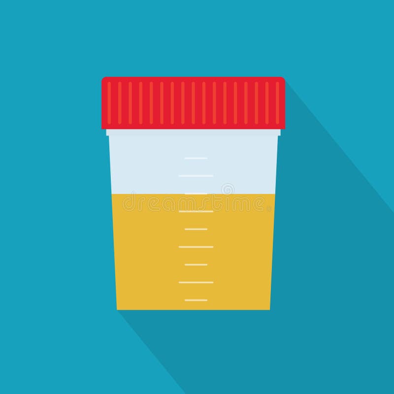 Urine Sample for Laboratory Analysis Stock Vector - Illustration of ...