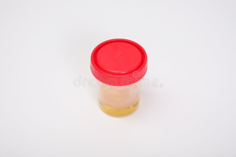 Urine Sample In A Plastic Container, Urinalysis On White Background ...