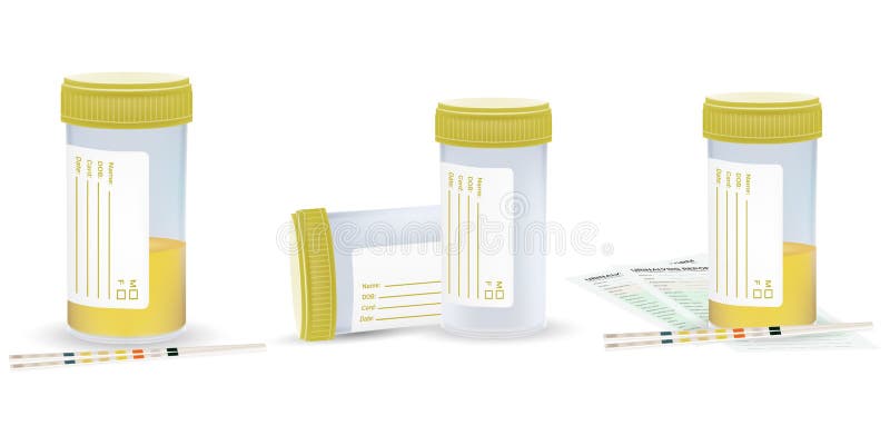 Urine Sample Set, Full and Empty Containers. Vector Illustration Stock ...