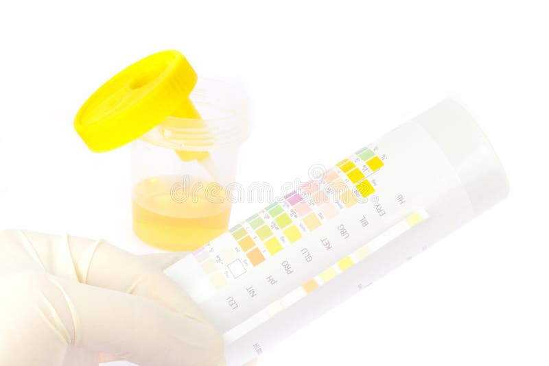 Urine Sample with Test Strips Stock Photo - Image of container ...