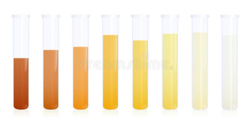 Urine Samples Colors Dehydration Chart Specimen Test Tubes Yellow ...
