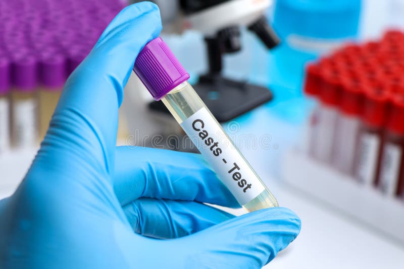 Urine Samples for Testing Casts in the Laboratory Stock Photo - Image ...