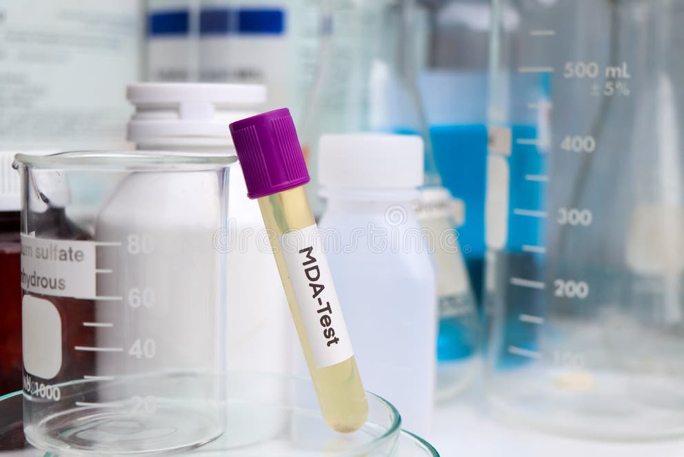 Urine Samples for Testing MDA in the Laboratory Stock Photo - Image of ...