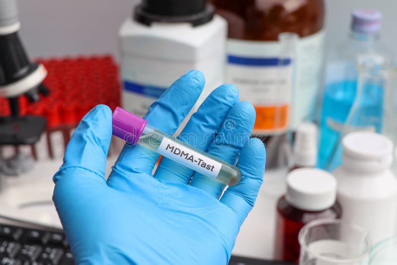 Urine Samples for Testing MDMA in the Laboratory Stock Photo - Image of ...