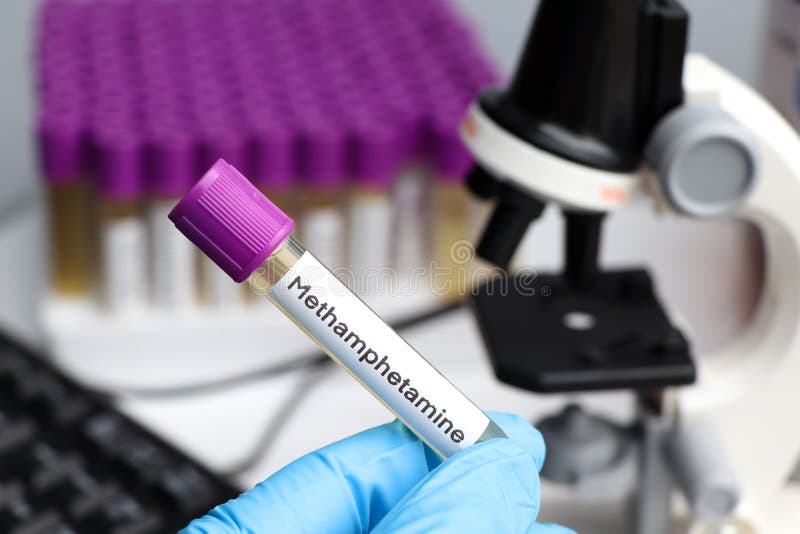 Urine Samples for Testing Methamphetamine in the Laboratory Stock Image ...