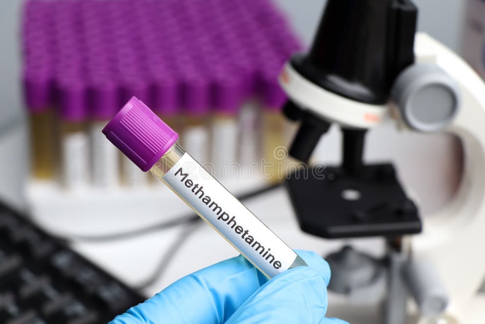 Urine Samples for Testing Methamphetamine in the Laboratory Stock Image ...