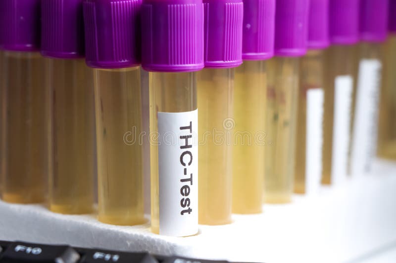 Urine Samples for Testing THC in the Laboratory Stock Image - Image of ...