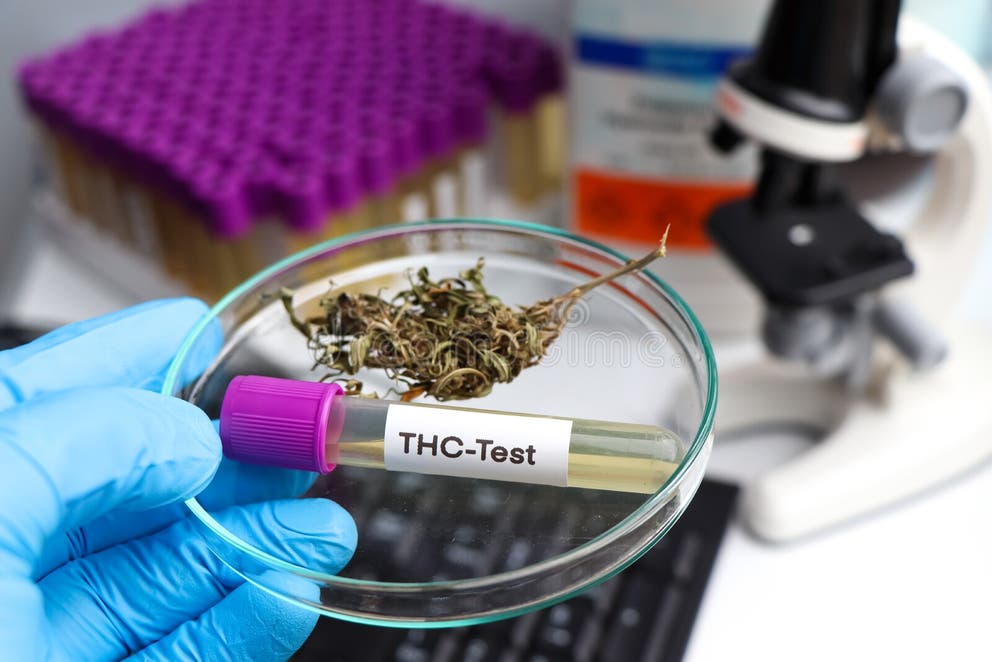 Urine Samples for Testing THC in the Laboratory Stock Photo - Image of ...