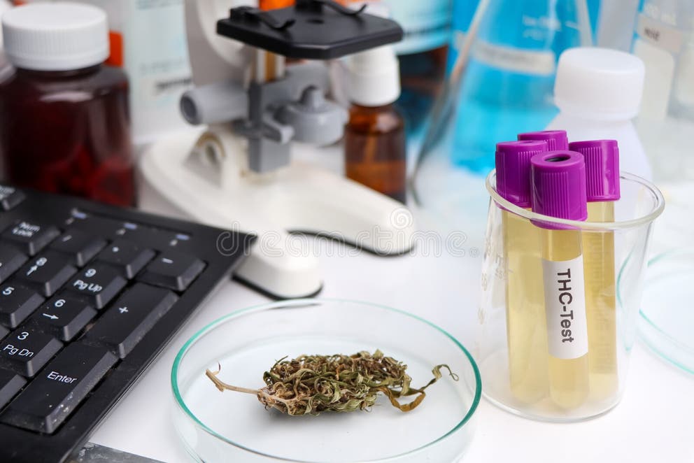 Urine Samples for Testing THC in the Laboratory Stock Image - Image of ...