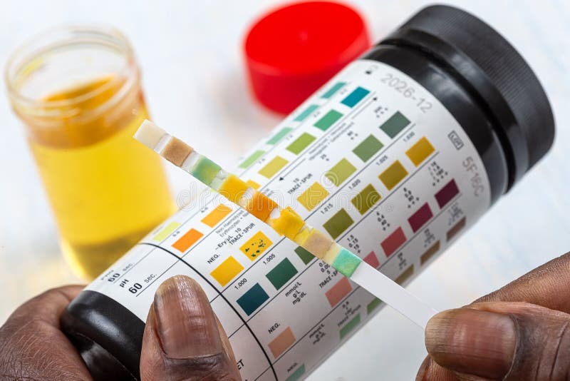 Urine Self-Tests-Self-Measurement Close Up View Stock Photo - Image of ...