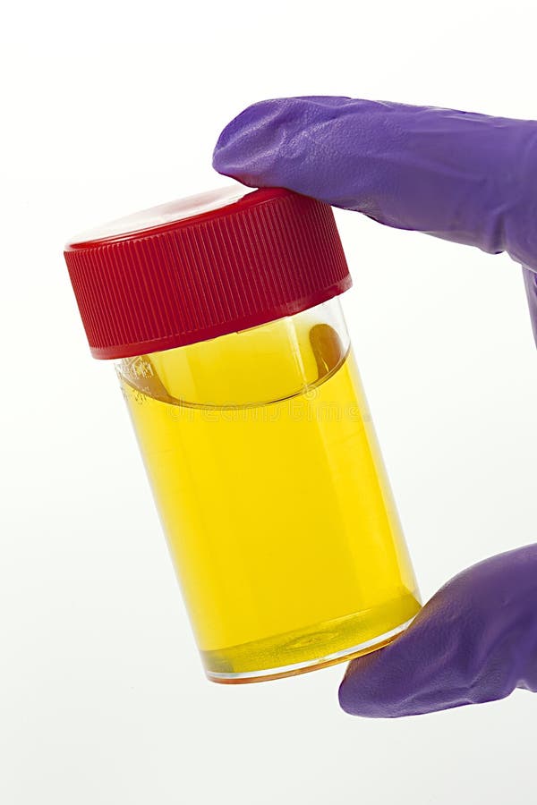 Urine Specimen - Medical Analysis Stock Image - Image of drug ...
