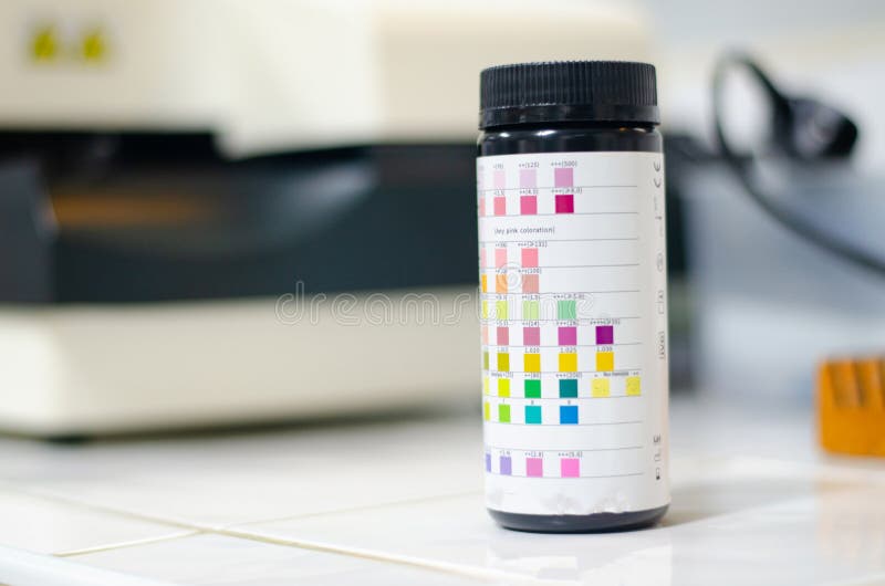 Urine Strip with Scientist in Lab Stock Photo - Image of examination ...