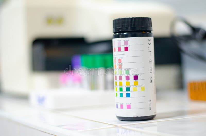 Urine Strip with Scientist in Lab Stock Photo - Image of examination ...