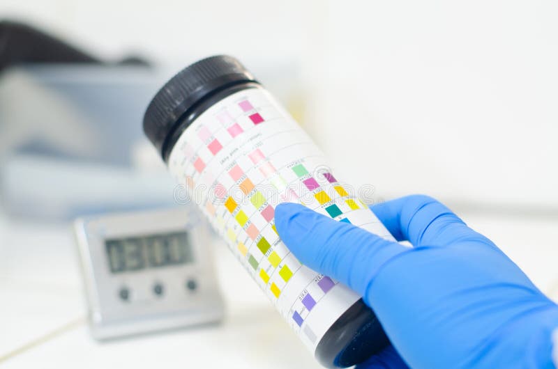 Urine Strip 11 Test in Laboratory Stock Image - Image of filter ...