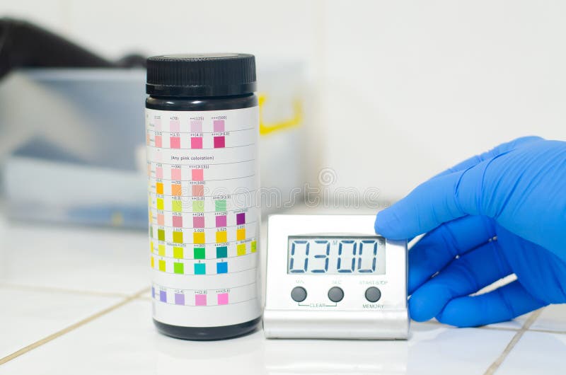 Urine Strip 11 Test in Laboratory Stock Photo - Image of laboratory ...
