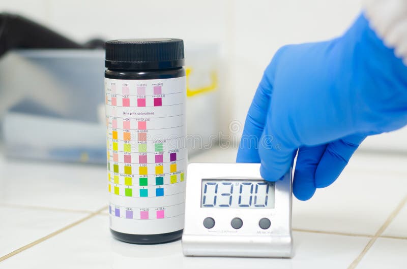 Urine Strip 11 Test in Laboratory Stock Photo - Image of clinic, doctor ...