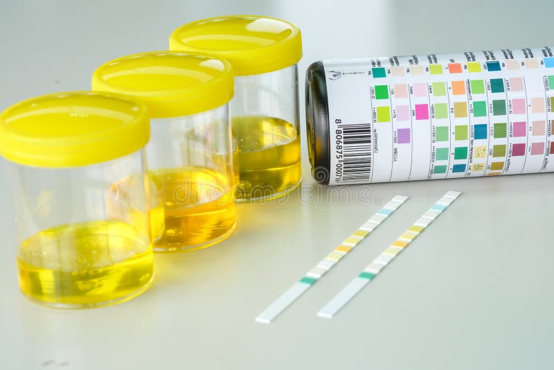 Urine Strip Test for Urinalysis. Stock Photo - Image of urine, organ ...