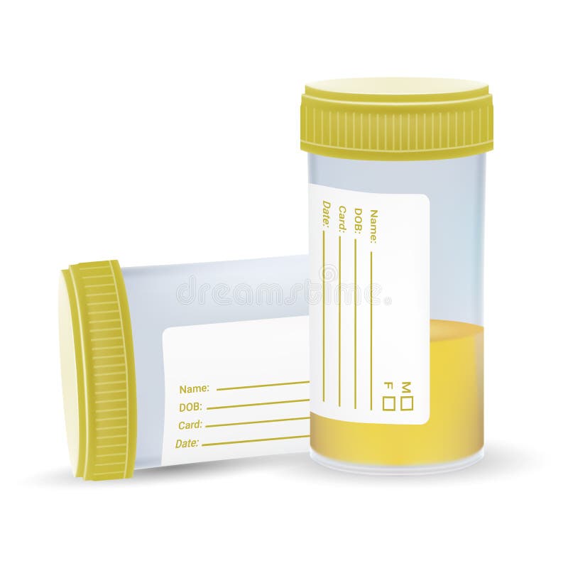 A Sample of Urine. Laboratory Analysis of Urine Using Test Strips ...