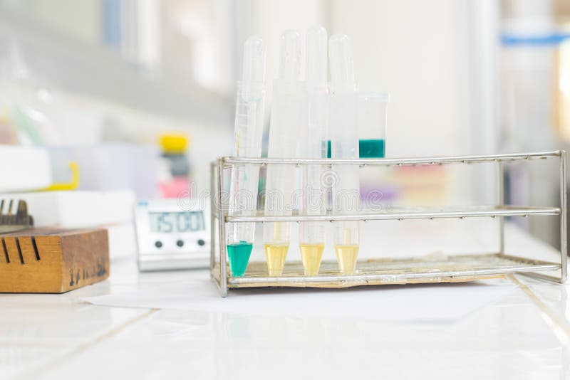 Specimen Met Urine Voor Urineonderzoek in Laboratorium Stock Afbeelding ...