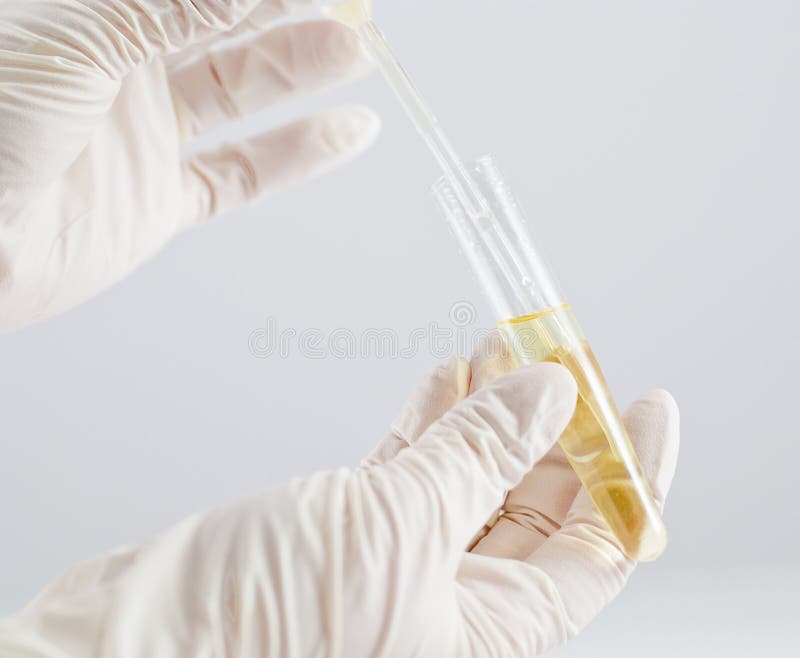 Urin-Probe stockbild. Bild von forschung, analyse, gesundheit - 8529759