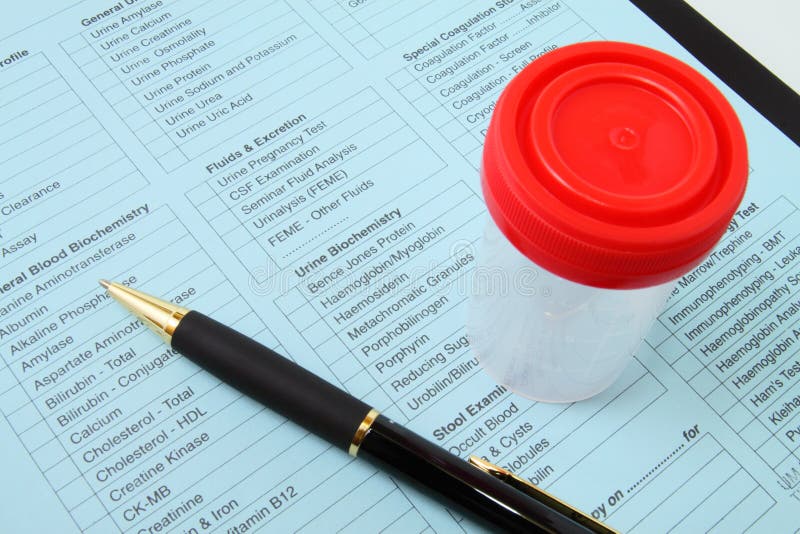 Urinprobe Auf Einer Laborform Stockfoto - Bild von examine, gesundheit ...
