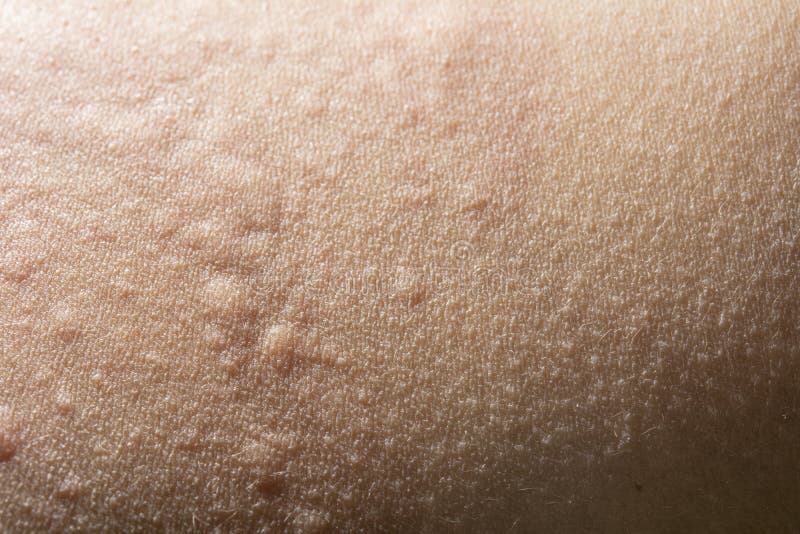 1,474 Skin Scratch Close Up Stock Photos - Free & Royalty-Free Stock ...