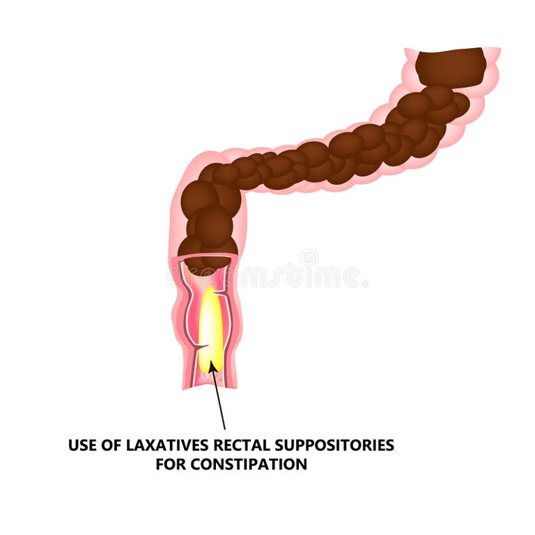 Rectal Suppositories Stock Illustrations 38 Rectal Suppositories