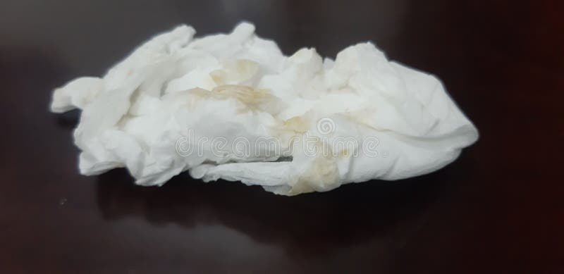 Used Tissue Was an Organic Waste Stock Image - Image of waste, tissue ...