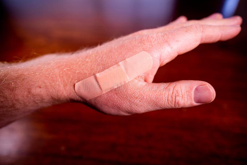 Using a band aid on a hand stock image. Image of accident - 261481393