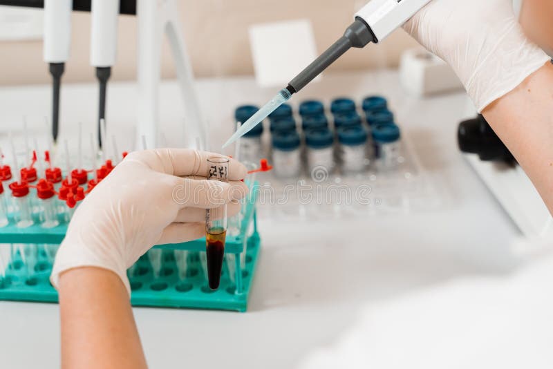 Using Microdoser for Blood Analysis and Test in Laboratory. Medical ...