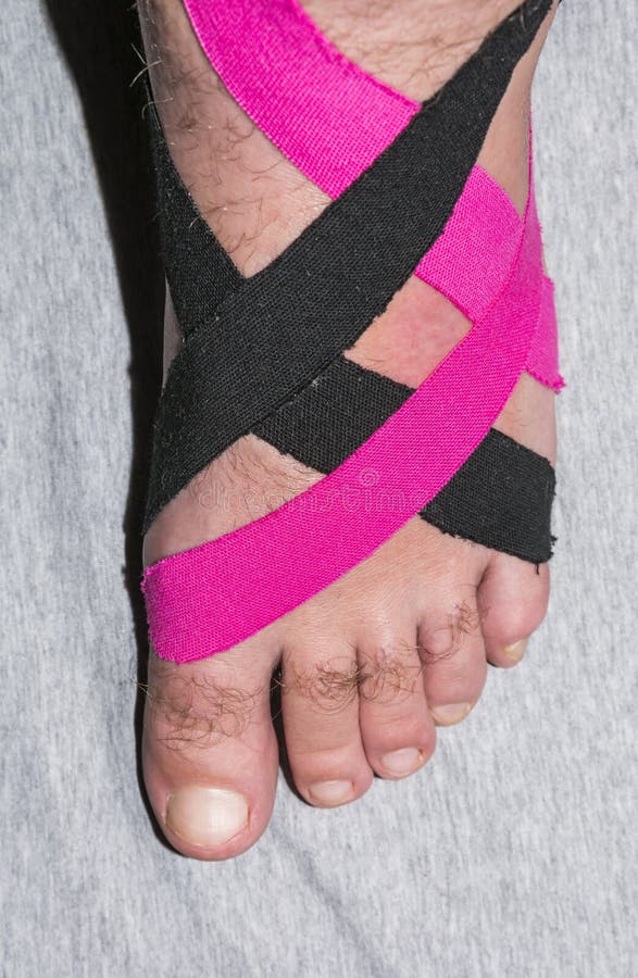 Uso De Remiendos En Terapia Imagen de archivo - Imagen de atletismo ...