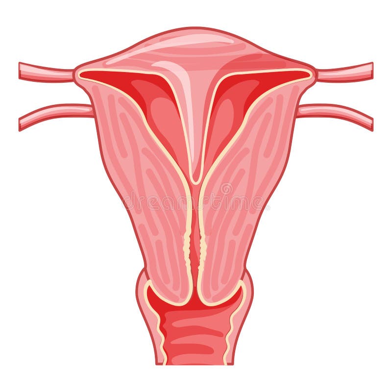 Set Of Uterine Fibroids Female Leiomyomas Reproductive System Uterus In