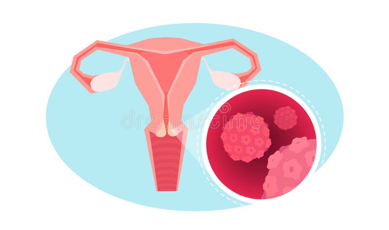Female Uterus Fallopian Tubes Stock Illustrations – 500 Female Uterus ...