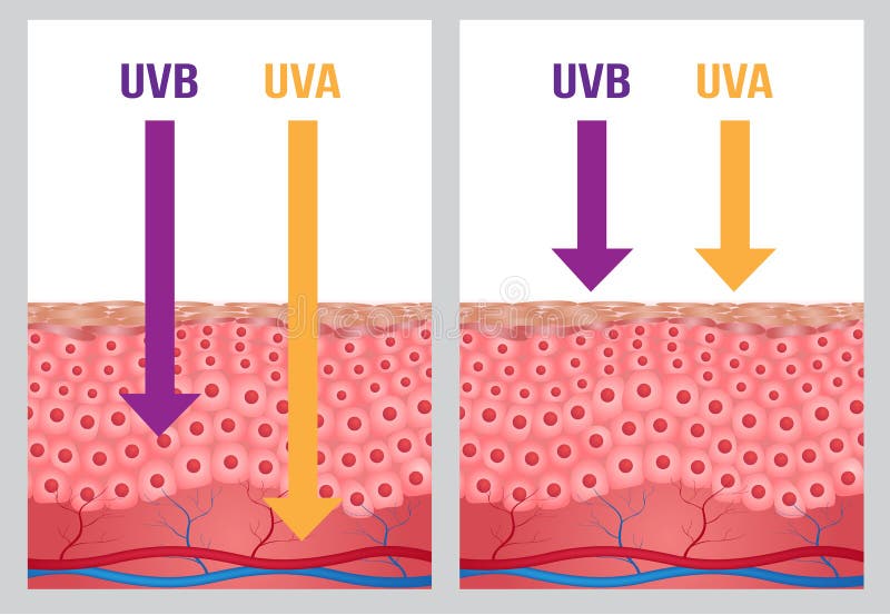 UV , Uv a and Uv B Protection Stock Illustration - Illustration of burn ...