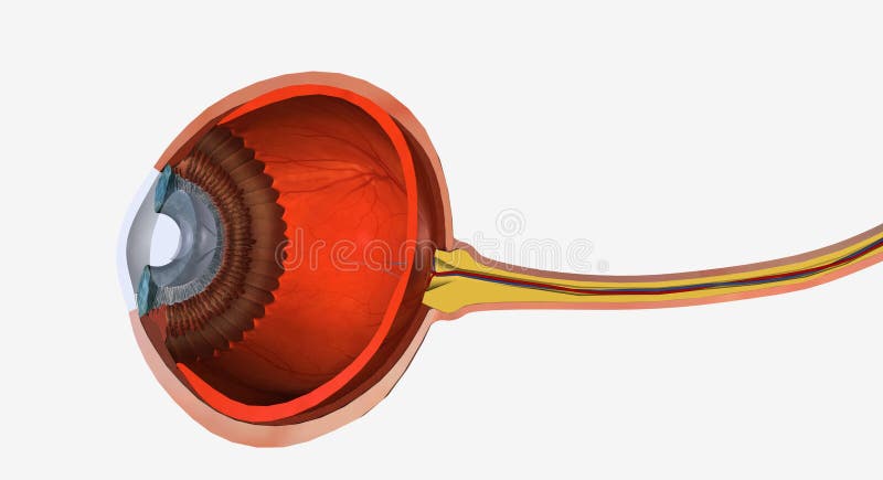 Uveitis is Swelling and Irritation of the Uvea, the Middle Layer Stock ...