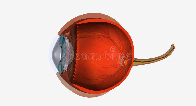 Uveitis is Swelling and Irritation of the Uvea, the Middle Layer Stock ...