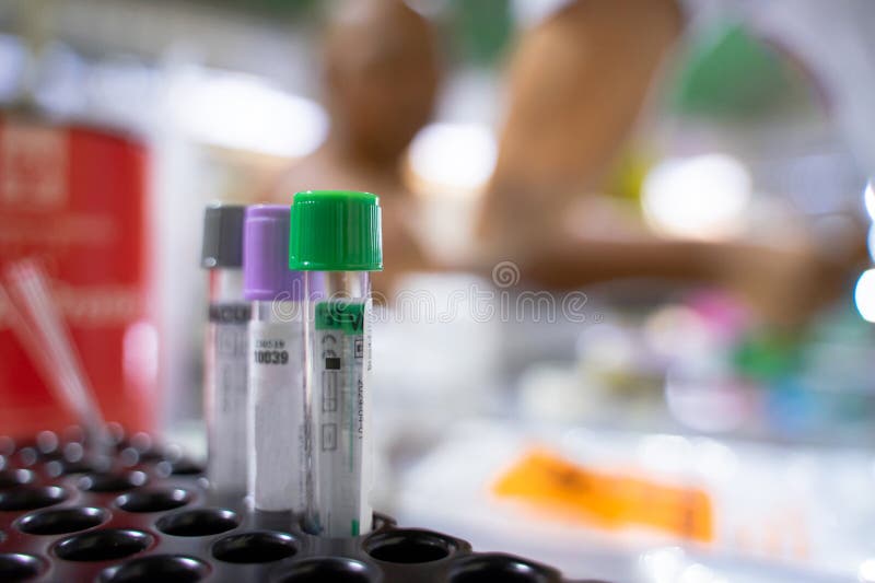 Vacuum Blood Sampling Tube for Medical Laboratory Stock Photo - Image ...