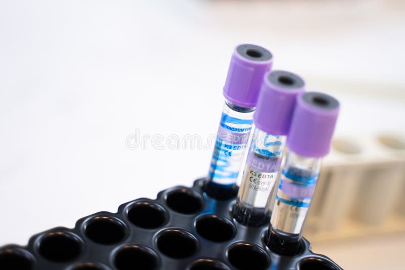 Vacuum Blood Sampling Tube for Medical Laboratory Stock Image - Image ...