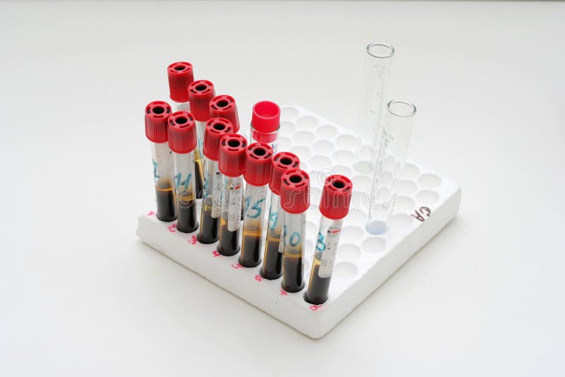 Vacuum Containers and Test Tubes for the Blood Stock Image - Image of ...