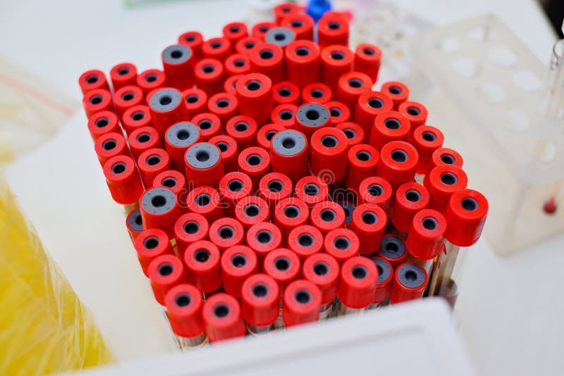 Vacuum Tubes for Blood Collection. Laboratory Blood Test Stock Image ...