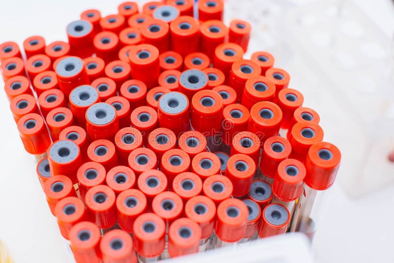 Vacuum Tubes for Blood Collection. Laboratory Blood Test Stock Image ...